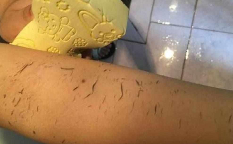 What is the black mud from the bath?The microscope is magnified 100 ...