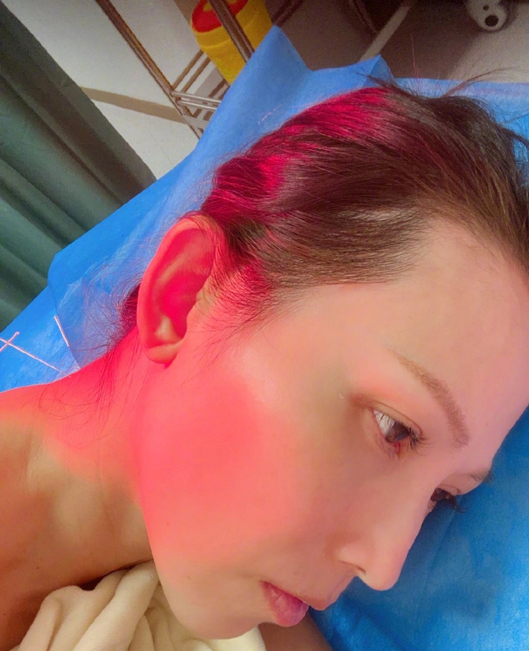 48-year-old actor Cai Shaofen was injured doing acupuncture!Dozens of ...