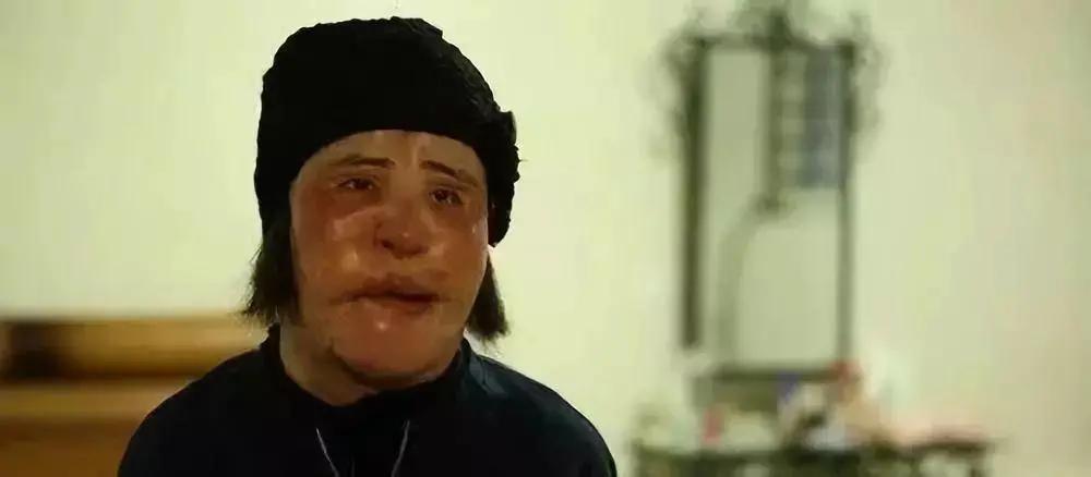 Korean female singer Han Huijing: 28-year-old plastic surgery ...