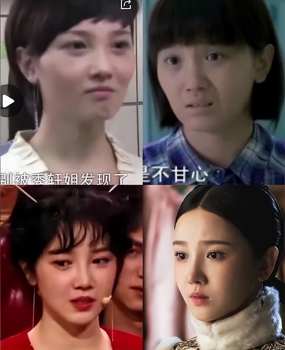 Chen Xiaojun blew himself up about the plastic surgery process, and the ...