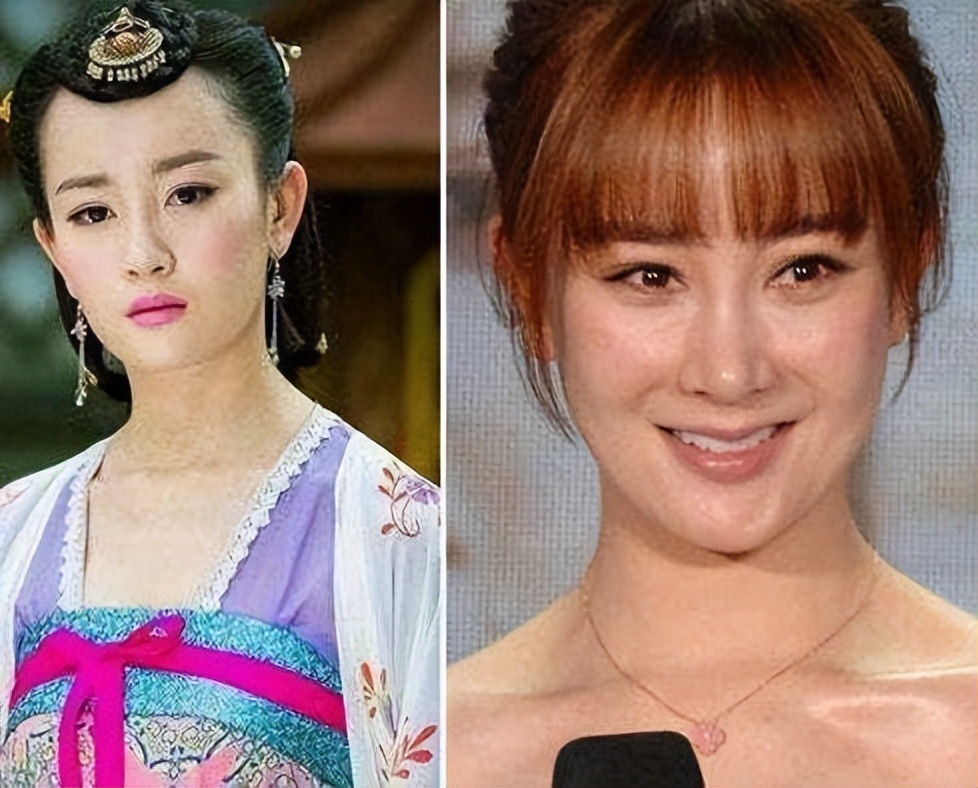 Several stars with excessive plastic surgery, with stiff faces and ...