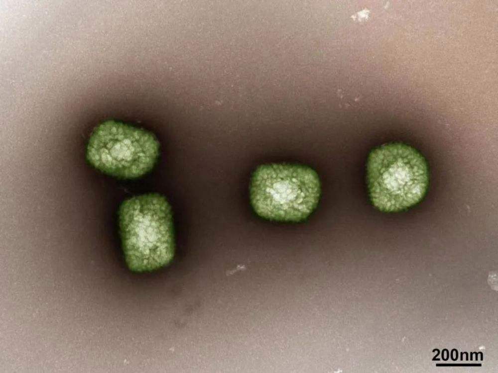 The 48,500-year-old virus was resurrected and is still infectious. What ...