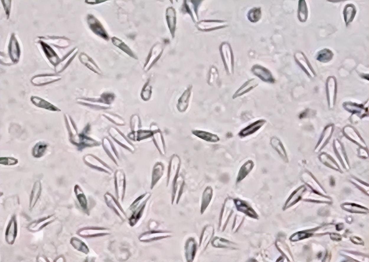 What is so special about truffles? What role do slugs play in research ...