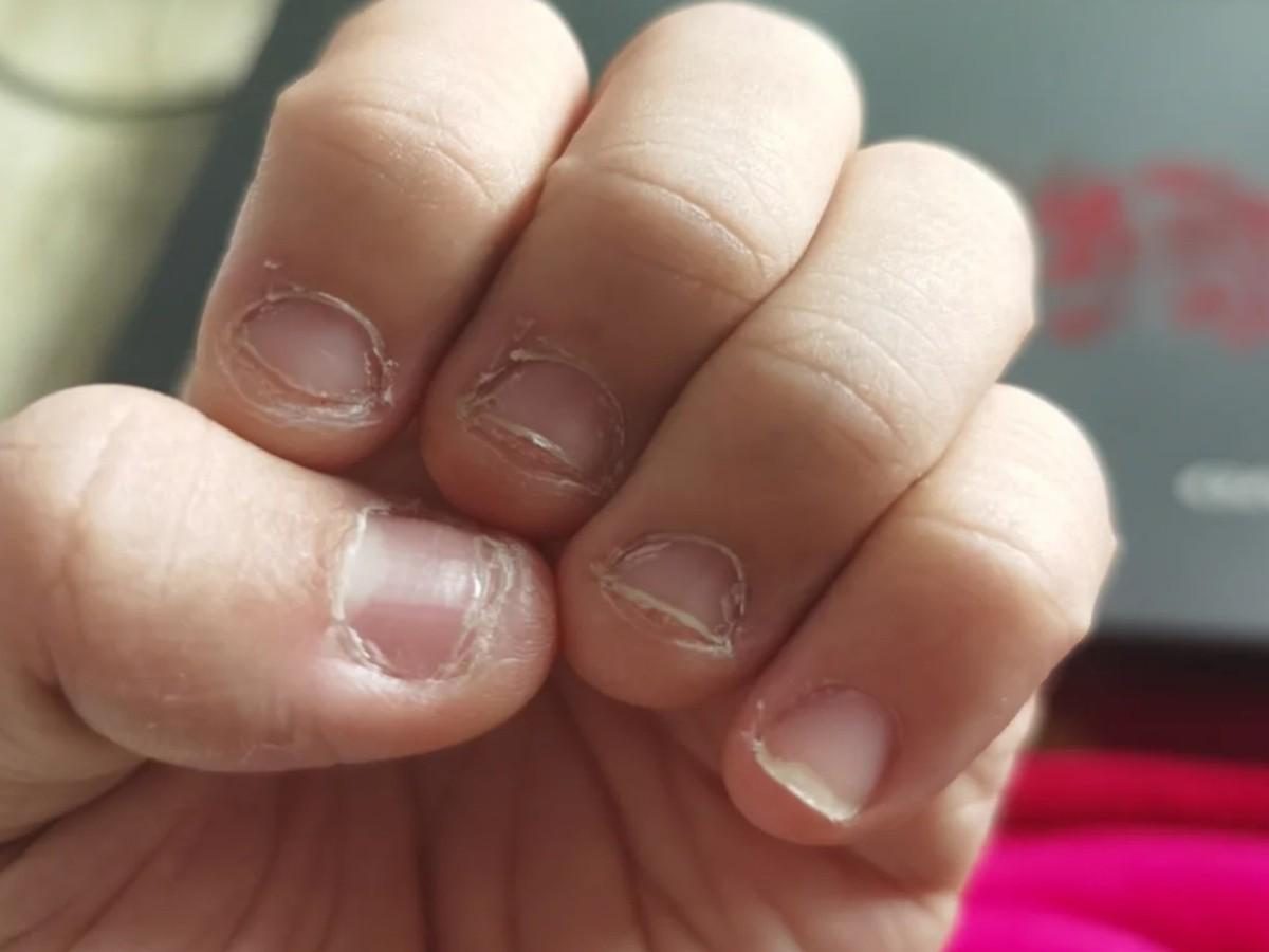 Children who have a "hobby" of gnawing their nails may have personality ...