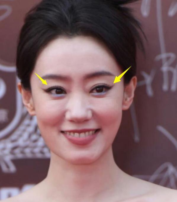 Huabiao reveals: Lou Yixiao's new changes in plastic surgery, Guan ...