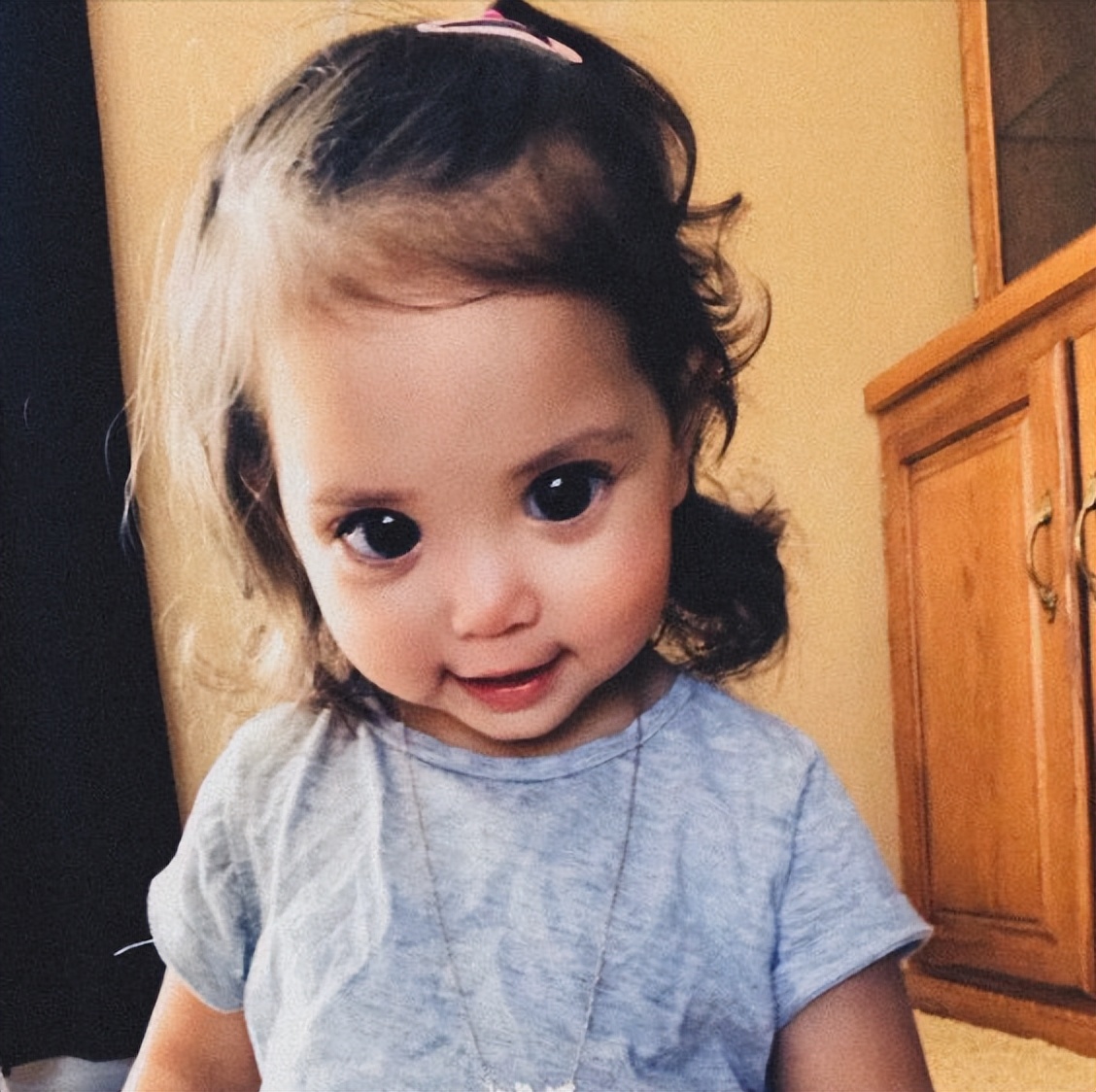 20 Humans With Rare Genes, There Are So Many Unique Humans In The World ...