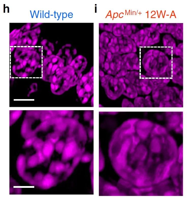 Stochastic optical reconstruction microscopy STORM reveals the ...