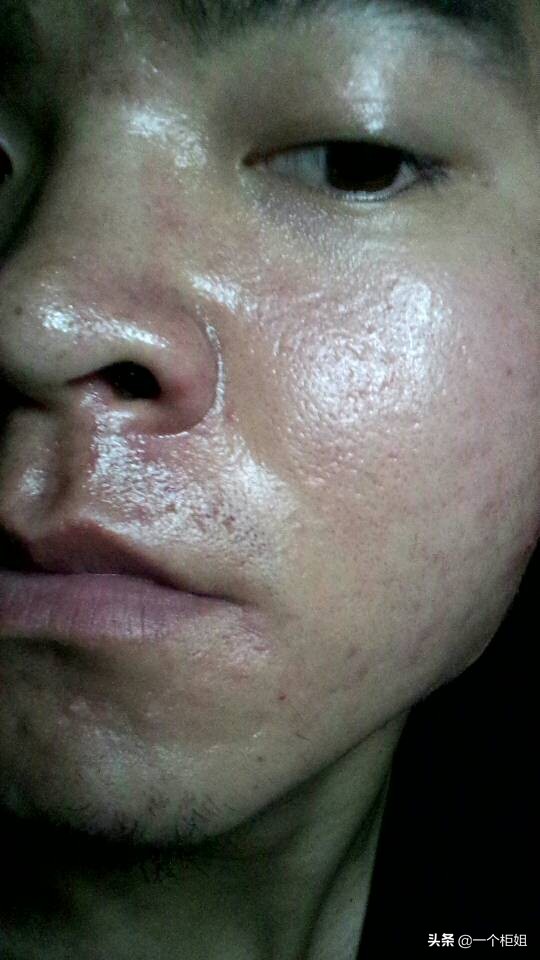 What is the white stuff that sticks out of the nose? - iNEWS