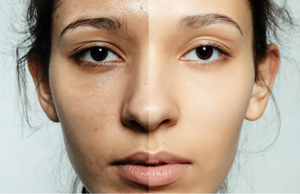 Don't be a "yellow-faced woman"!3 tricks to teach you to get rid of ...