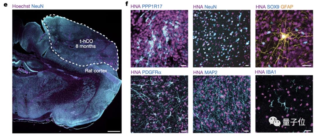 The human-mouse hybrid brain has appeared!Stanford University 7 years ...