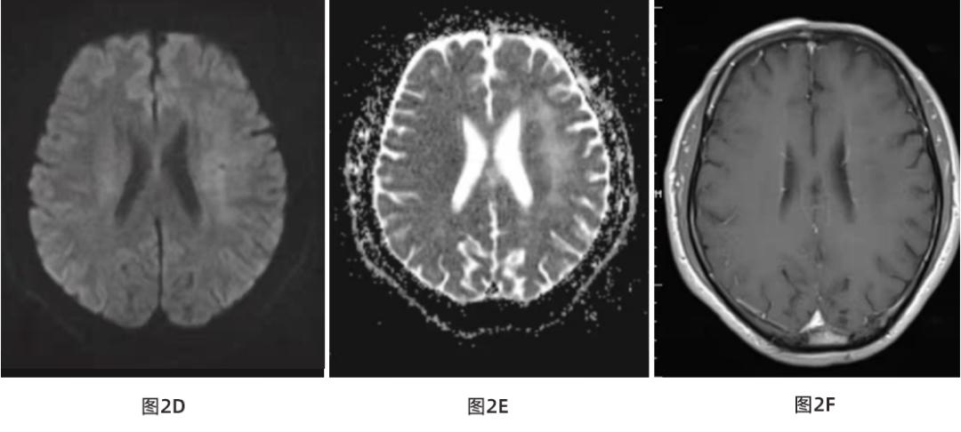 Scalp "knife cut" sign?There is another "hidden feeling" in the skull ...