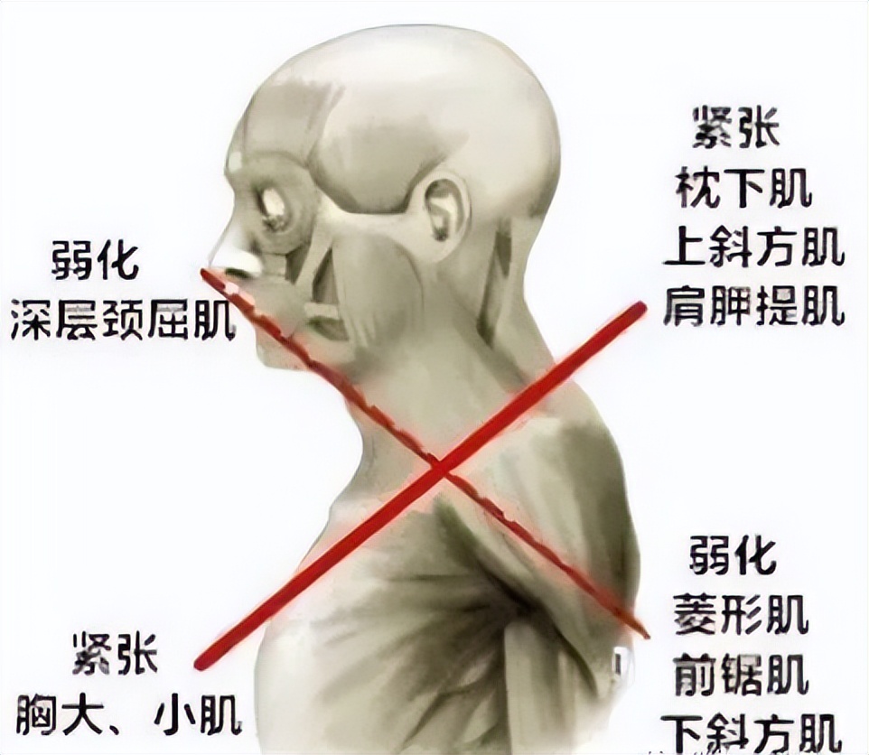 Neck and Shoulder Muscle Stretch Anatomy Atlas! 10 stretching exercises ...