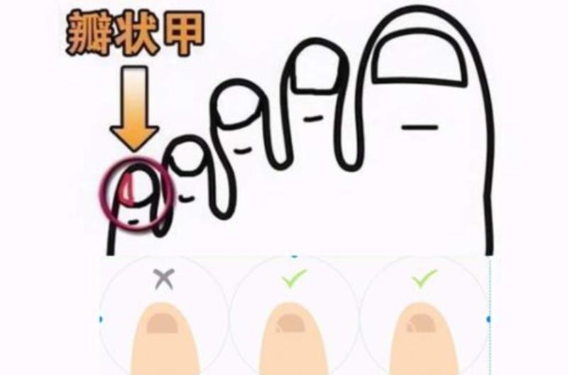 If you have two toenails on your little toe, you may not be a pure Han ...