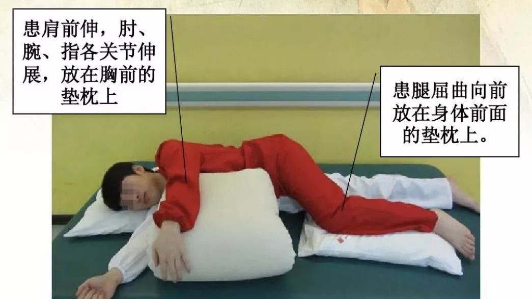 Diagram of stroke rehabilitation motor function training - iNEWS