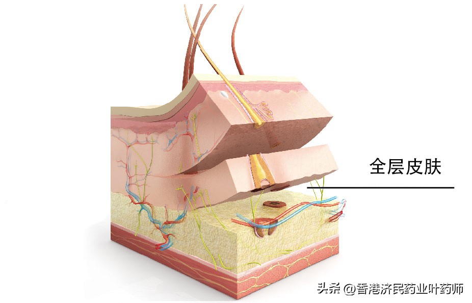 FDA Expands RECELL System Approval to Treatment of Full-Thickness Skin ...