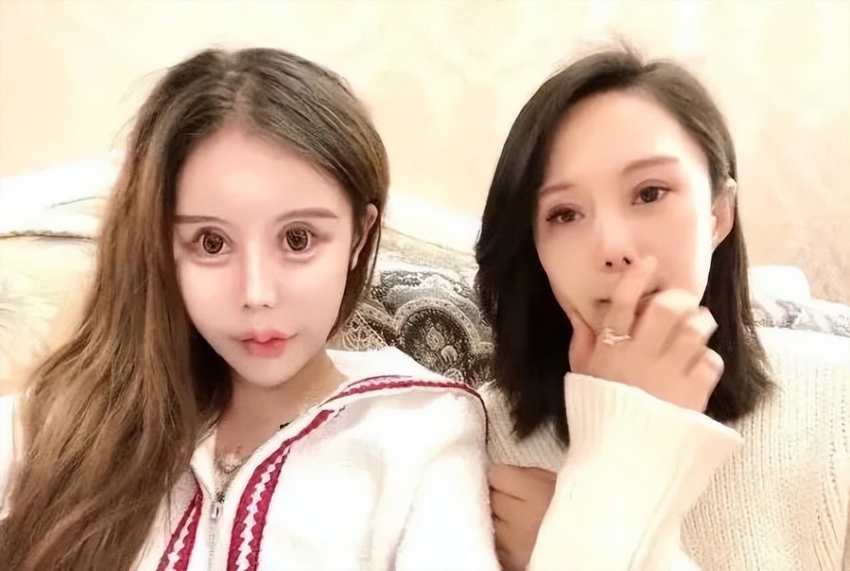 Internet celebrity Zhou Chuna: 13-year-old plastic surgery cost 4 ...