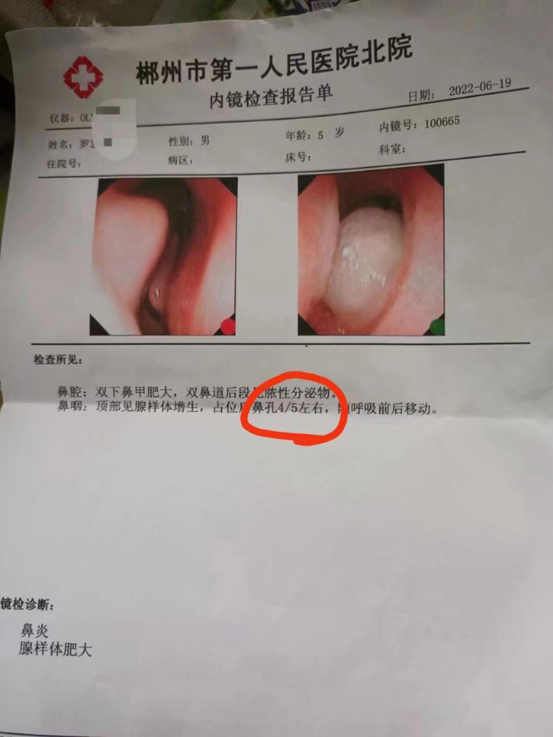 Experience of Traditional Chinese Medicine in Treating Adenoid ...