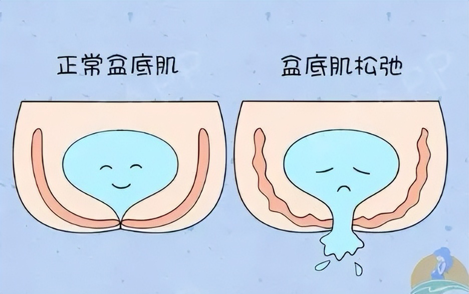 what-should-i-do-if-i-leak-urine-after-giving-birth-postpartum-repair