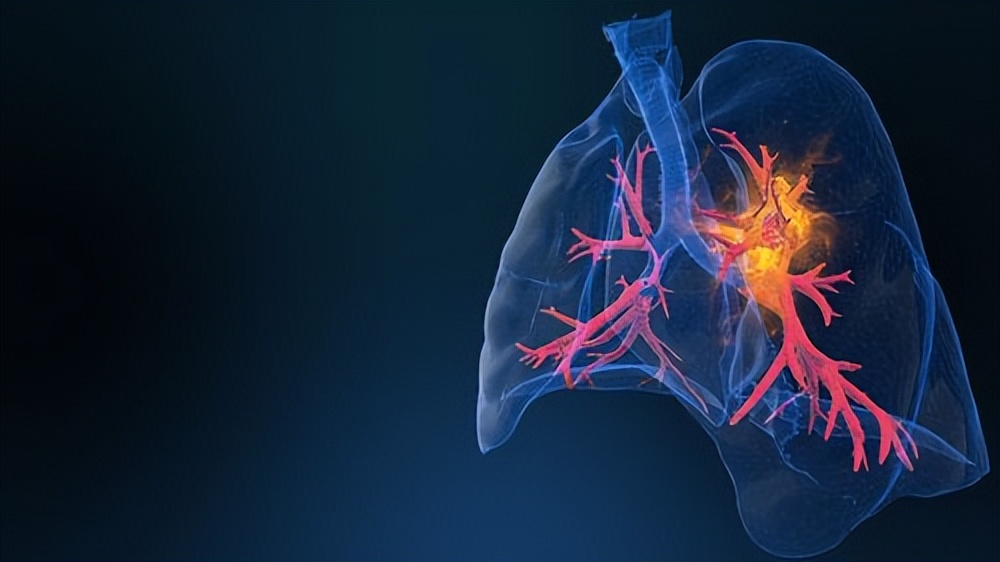 26-year-old lung cancer came to the door, what step are you missing to ...