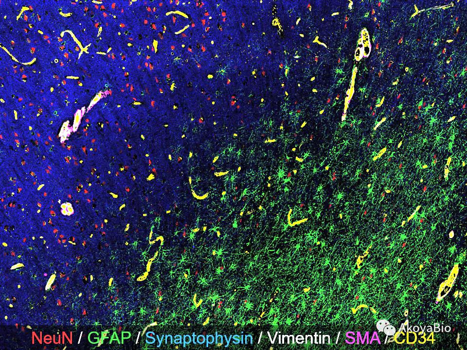 CODEX Ultra Multicolor Immunofluorescence and Phenoptics Multicolor ...