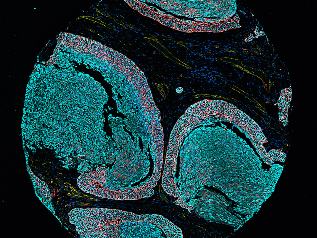 Appreciation of Akoya's Classic Cases of Spatial Biology and Tissue ...