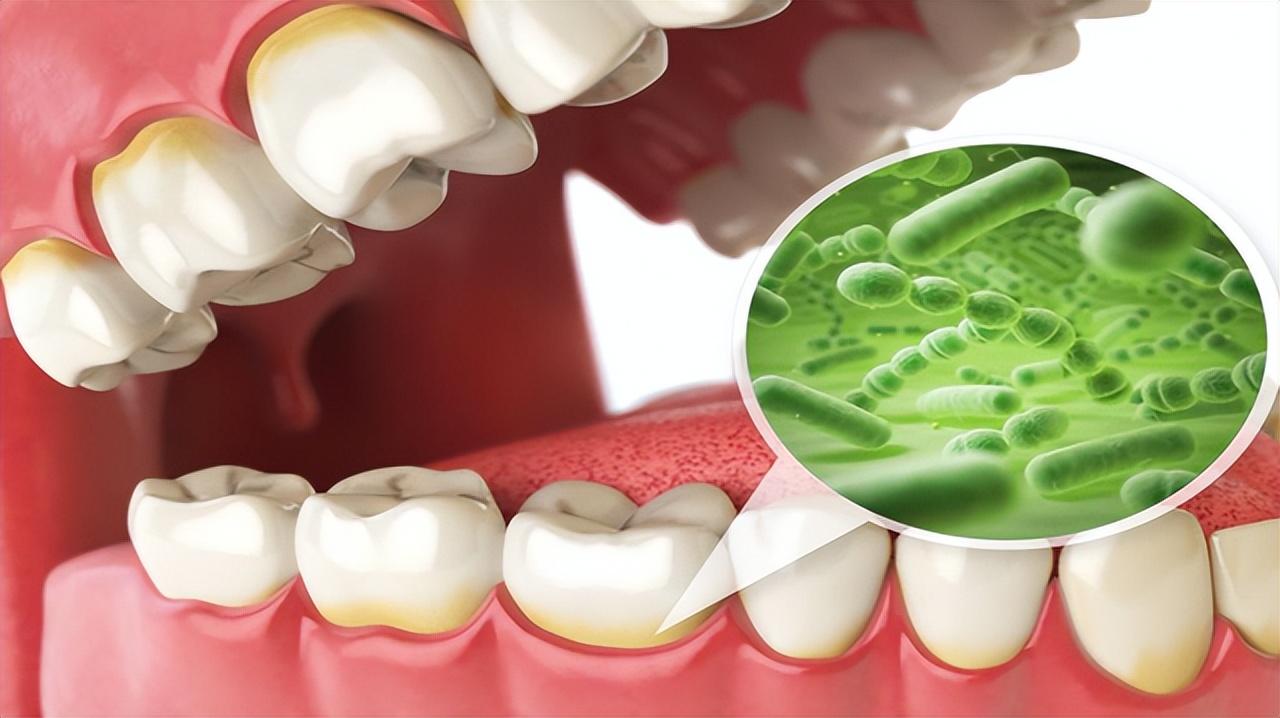 Why does something plucked from your teeth smell so bad, but you can't ...