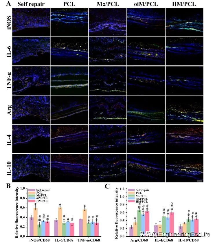 "AHM": mixed cell membrane functionalized matrix regulates inflammatory ...