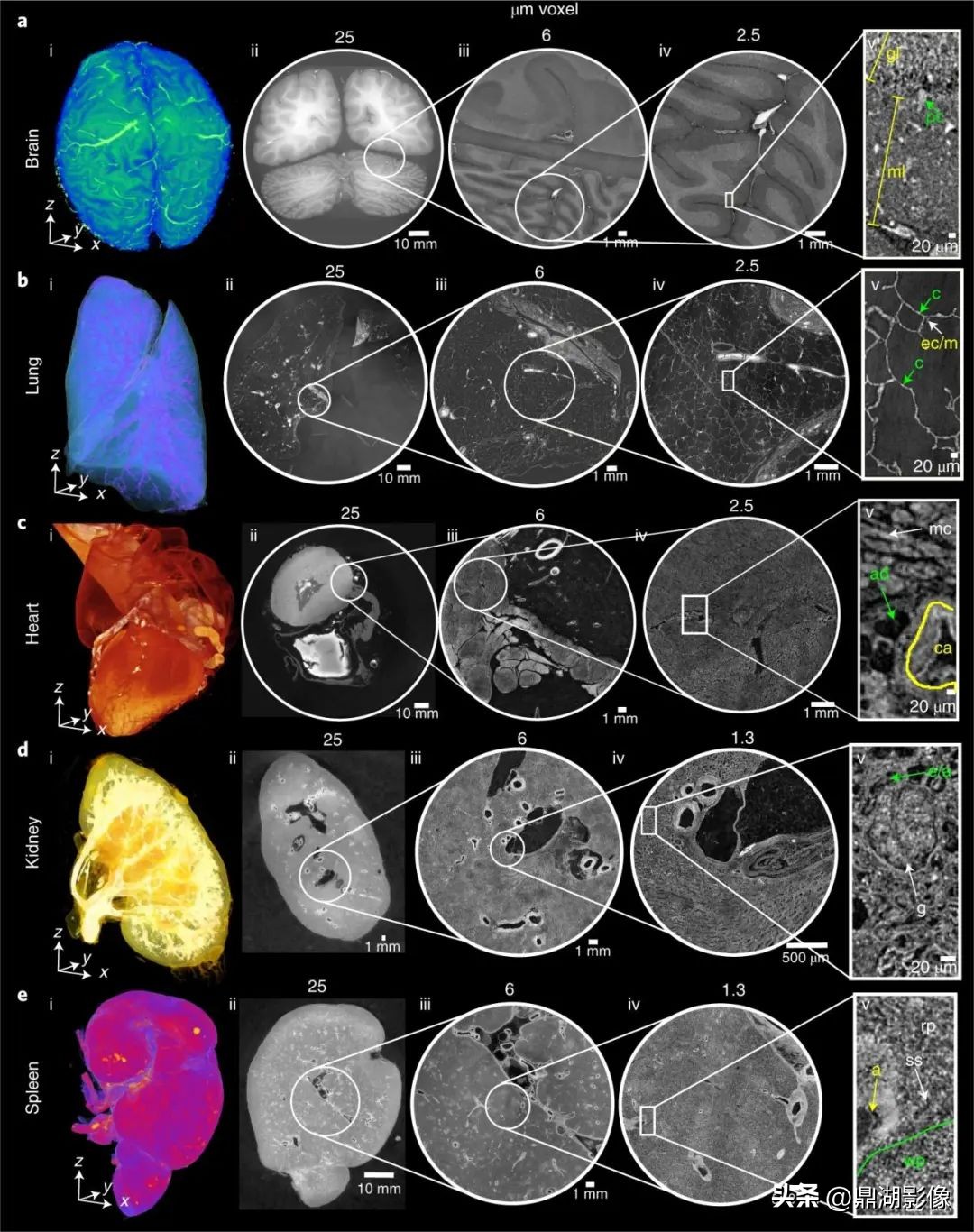 Eye-opener!This latest tomography technique, HiP-CT, is challenging ...