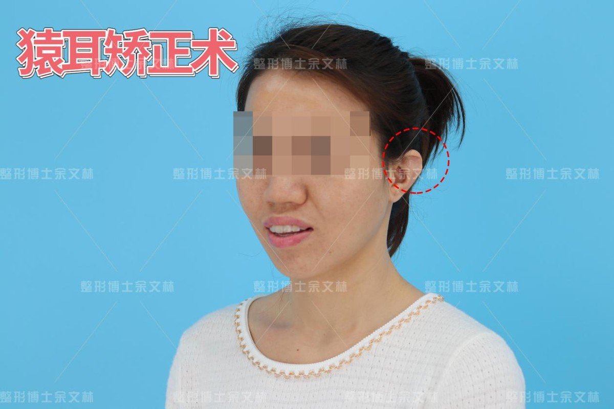 "Ape Ear Case Study" Are Elf Ears really good-looking?Miss Elf Ears ...