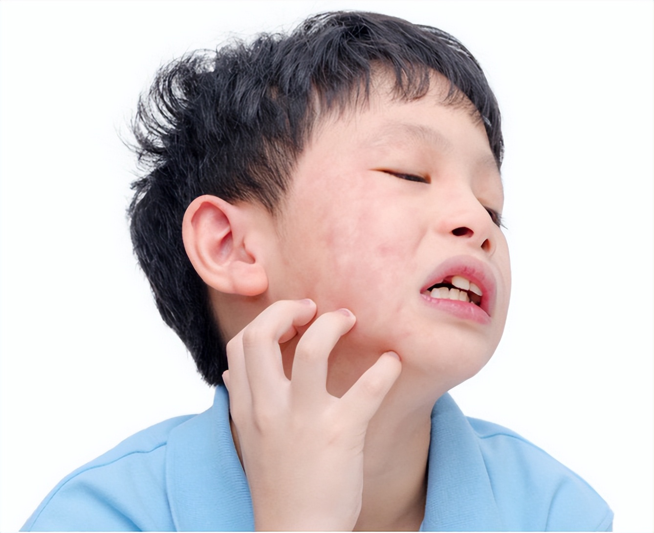 There are these signs on the child, the mites are already infested, put ...