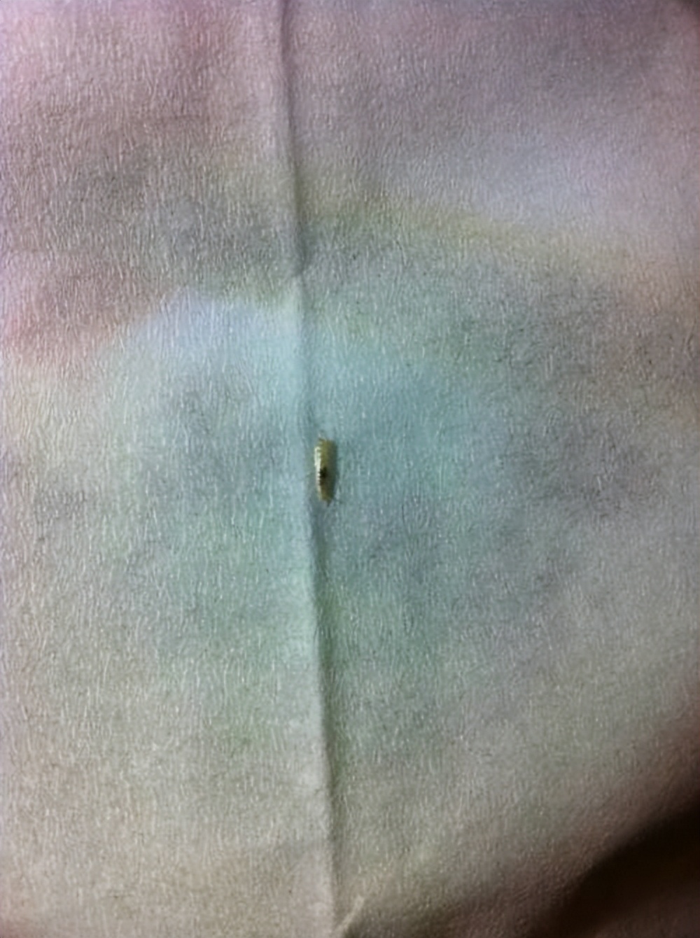 What is the "transparent bug" you see when you are in a daze? Why does ...