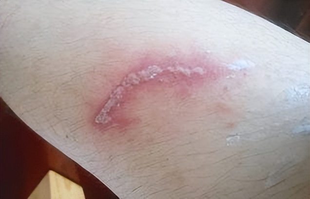 If you see this kind of bug in summer, don't slap it, it's very ...