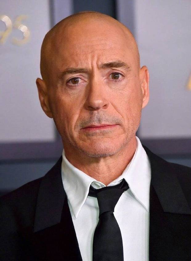 Iron Man is going bald!Robert Downey Jr.'s bald head looks old on the ...