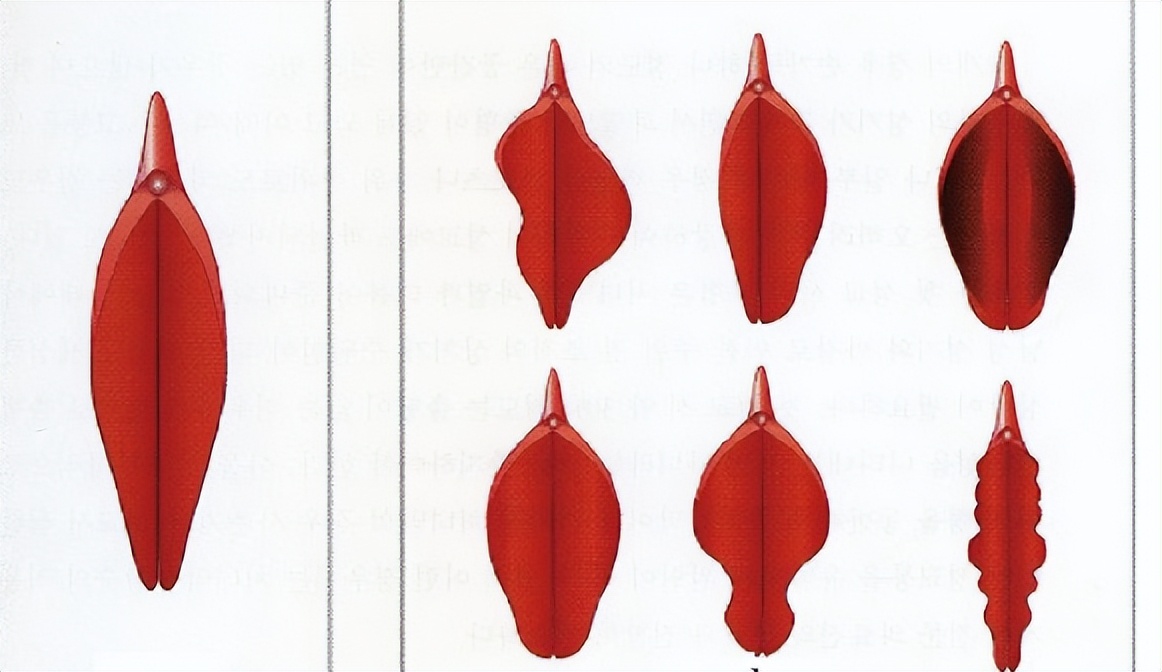 Shame on private surgery? |How to treat it correctly? - iNEWS