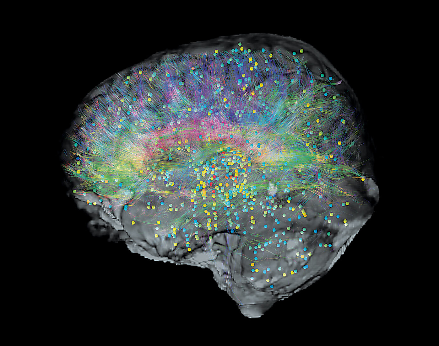When we're sad, the brain redraws its neural maps - iNEWS