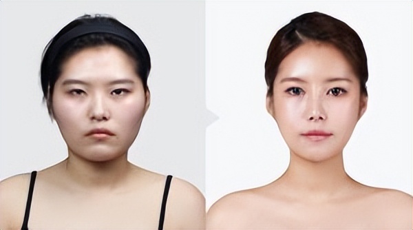 Several female stars who have "successful plastic surgery" seem to have ...