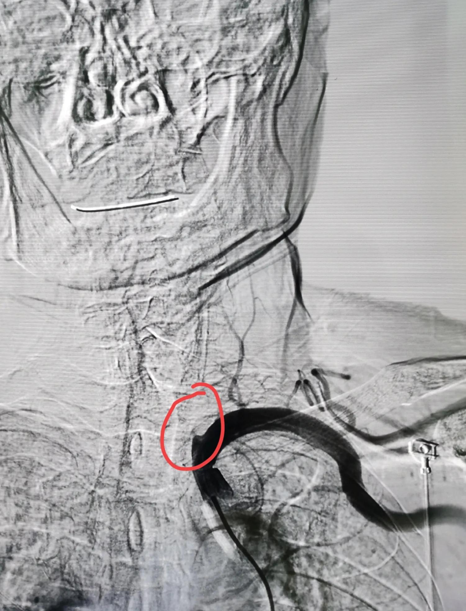 Consultation of a patient with dizziness and blurred vision - iNEWS