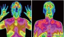 Comparison of the application and curative effect of medical infrared ...