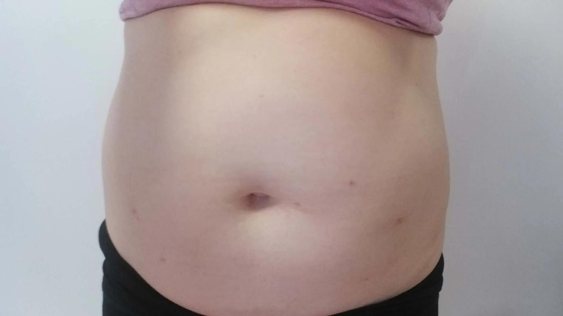 The order of postpartum repair, are you doing it right? - iNEWS