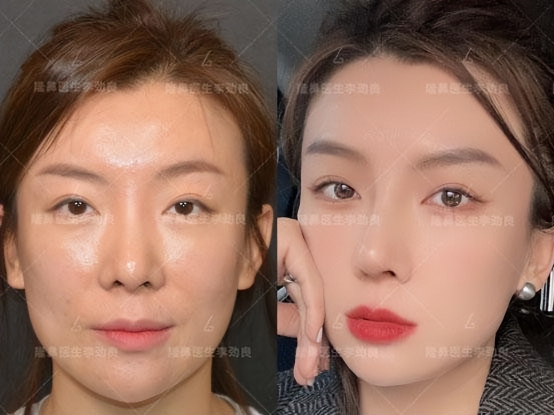 "Till The End Of The Moon" Luo Yunxi plastic surgery or skinny? This is ...