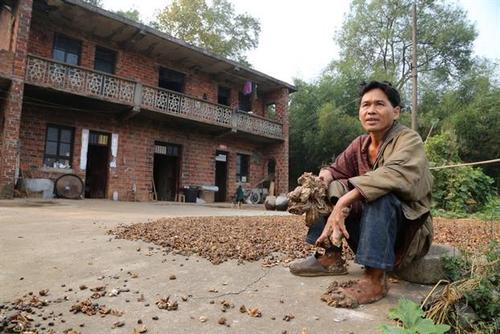 Hunan "tree man" Liu Zhongwen: The limbs are no different from the bark ...