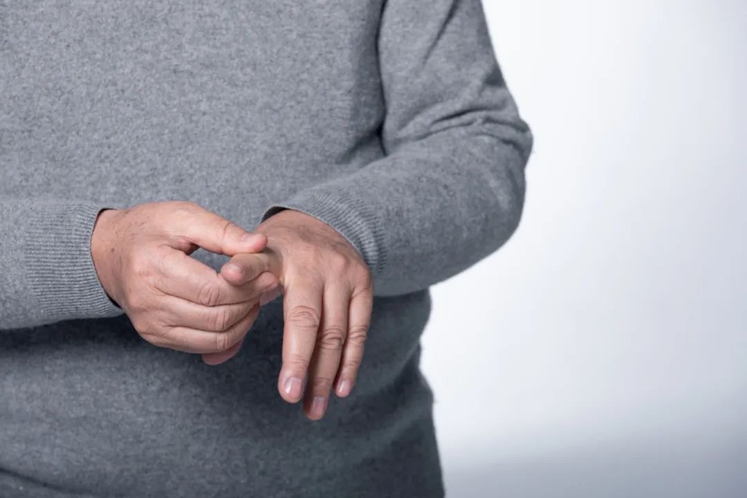 Learn 5 finger movements to relieve rheumatoid swelling and morning ...