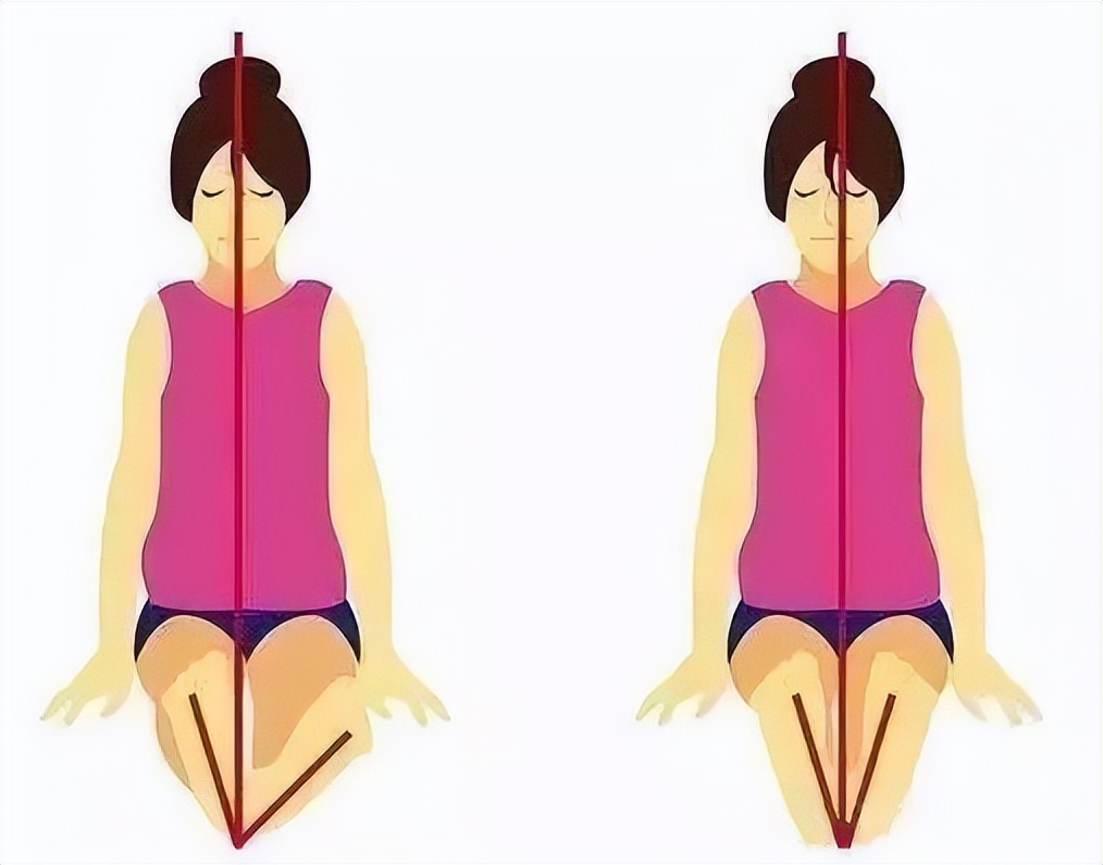 Most people's pelvis is "crooked" to teach you a trick to self-test - iNEWS