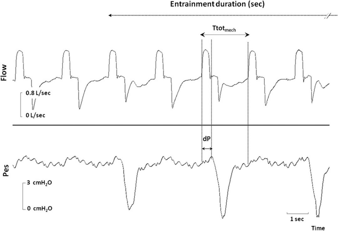 Professor Luo Hong: How to identify "reverse trigger" during mechanical ...