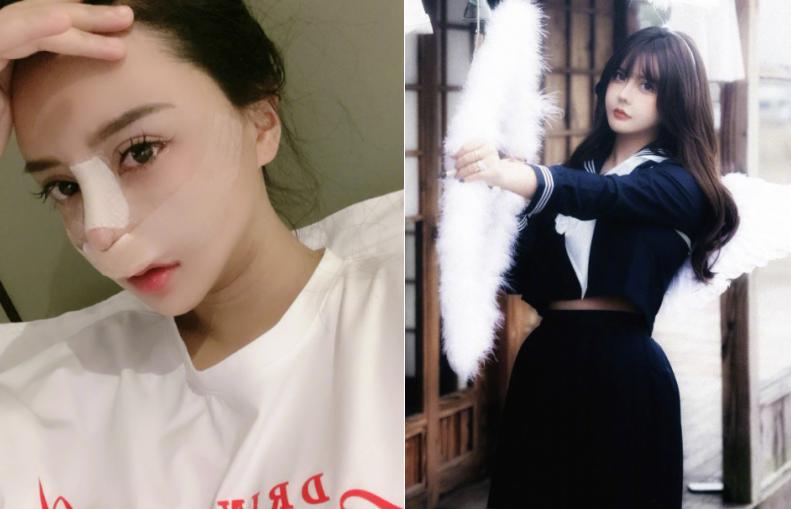 Net red Zhou Chuna spent 4 million plastic surgery!After five years of ...