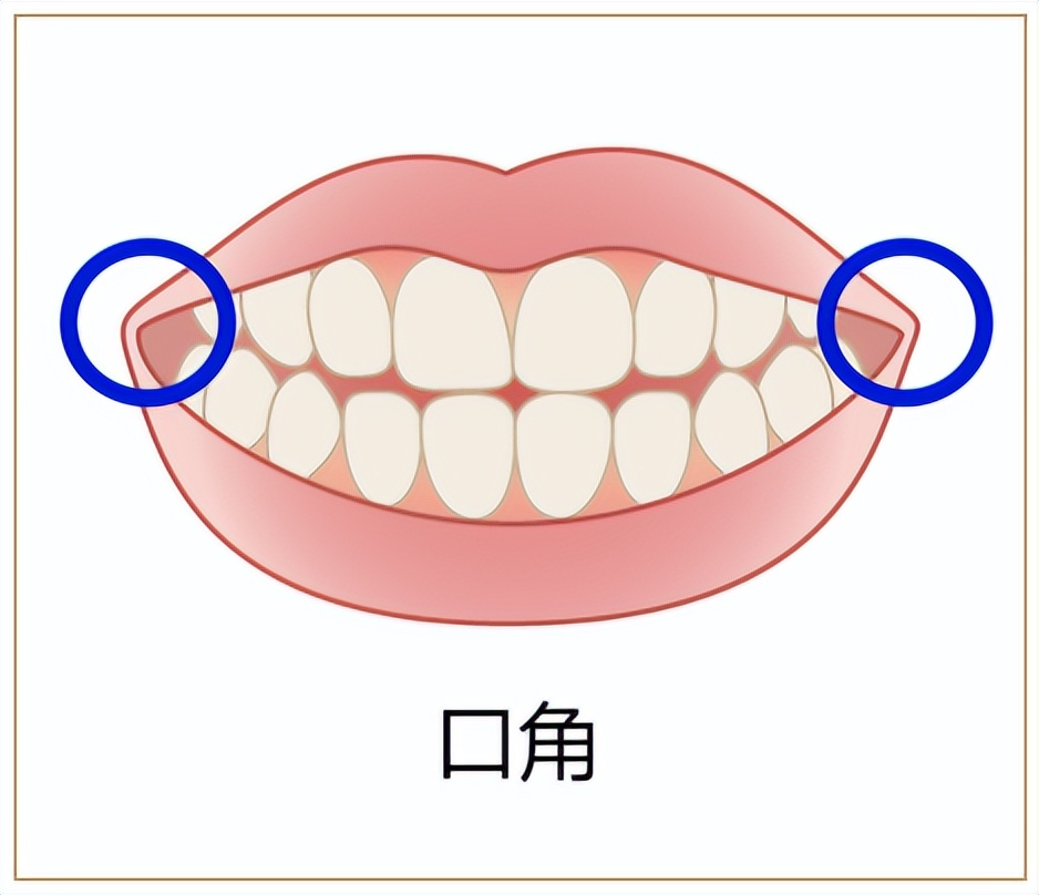 "Angular Cheilitis"What should I do if my child's mouth is always ...