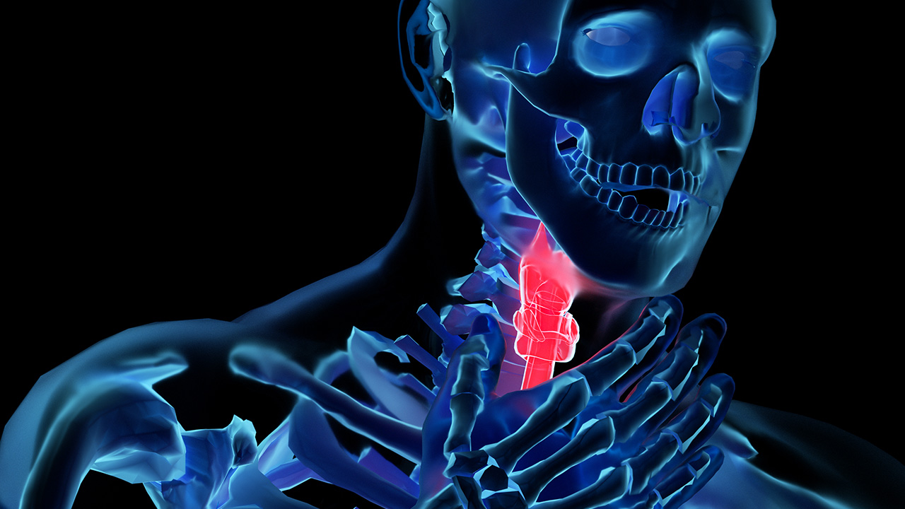 Feeling of a foreign body in the throat, can't cough or swallow?Two ...
