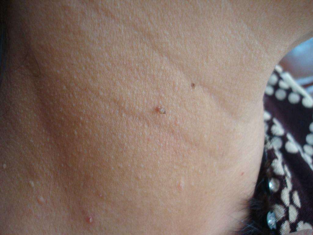 Don't ignore the "small particles" on the neck, pay attention, this is ...