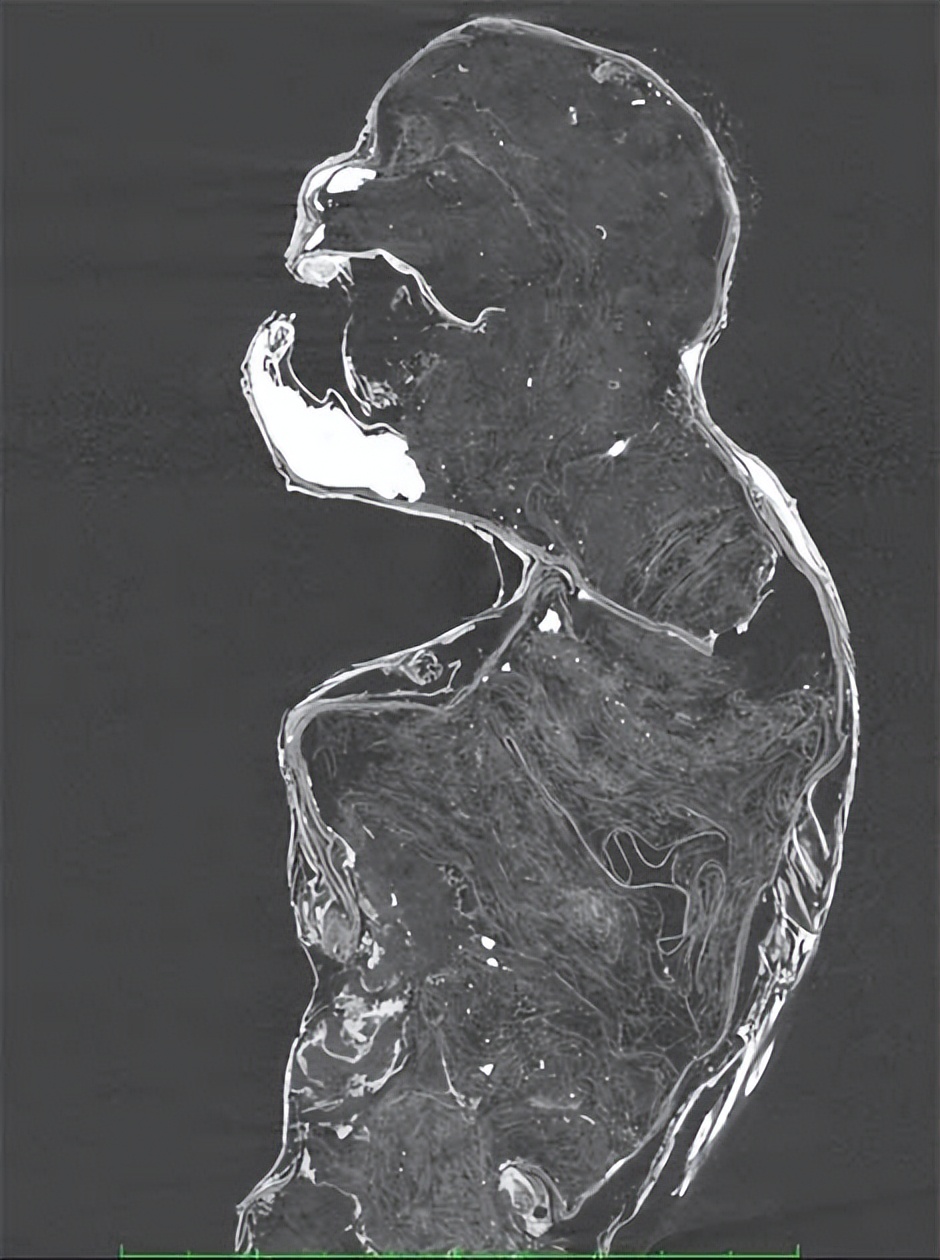 Historical Verification on Japanese Temple "Mermaid Mummy" - iMedia