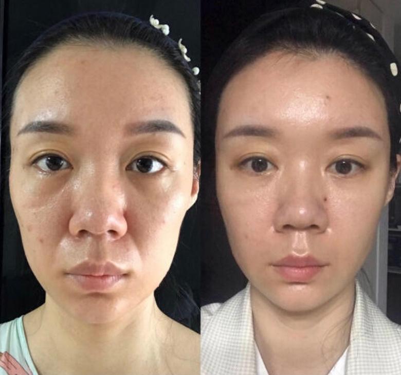 The cheeks are sunken, and the nose can see through the light. It is ...